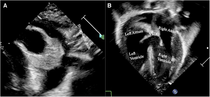 Frontiers | Case report: A novel combination of anomalies in a patient ...