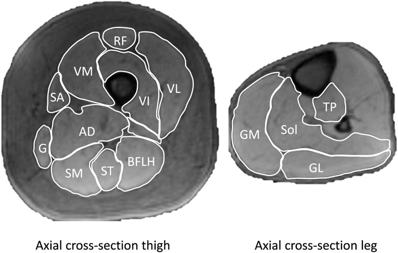 Frontiers | Human lower limb muscle cross sectional area scales with ...