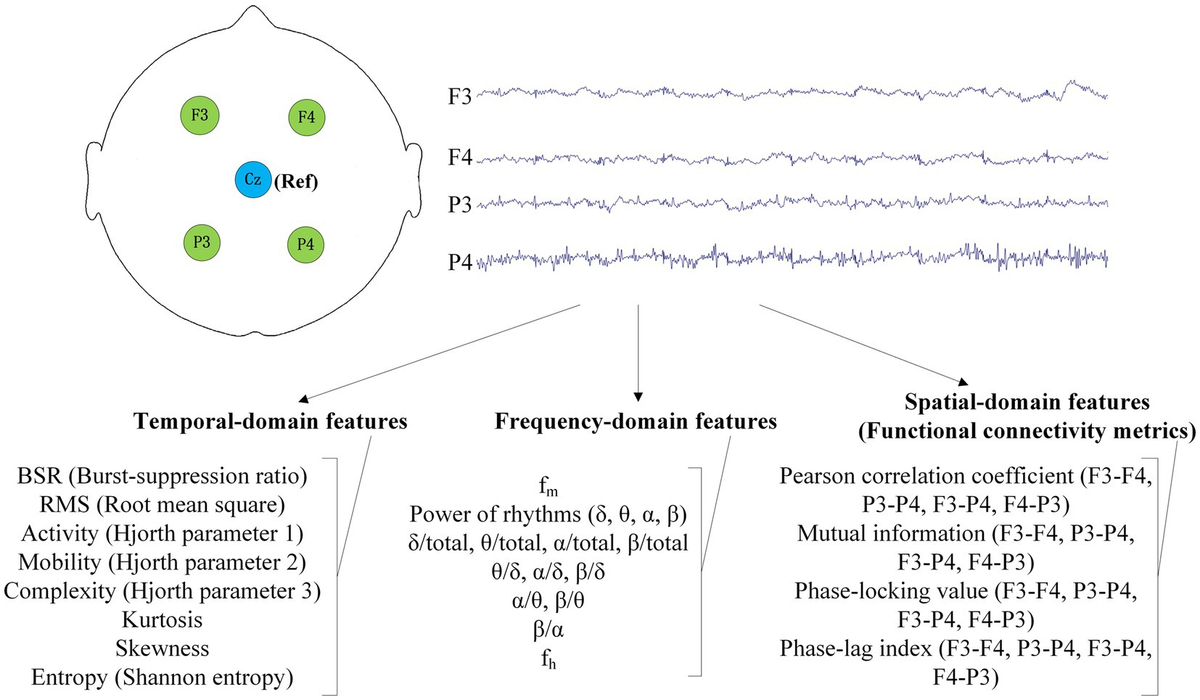 Frontiers | Prognosis of comatose patients with reduced EEG montage by combining quantitative ...