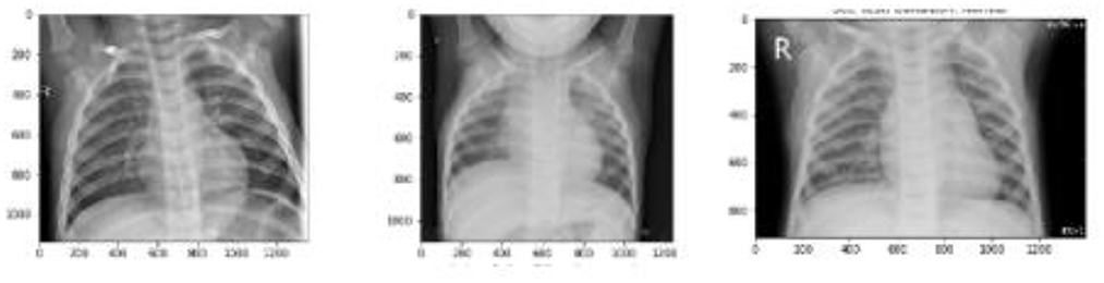 Frontiers | Deep learning models/techniques for COVID-19 detection: a ...