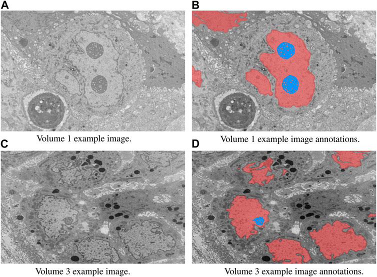 Frontiers | Efficient semi-supervised semantic segmentation of electron ...