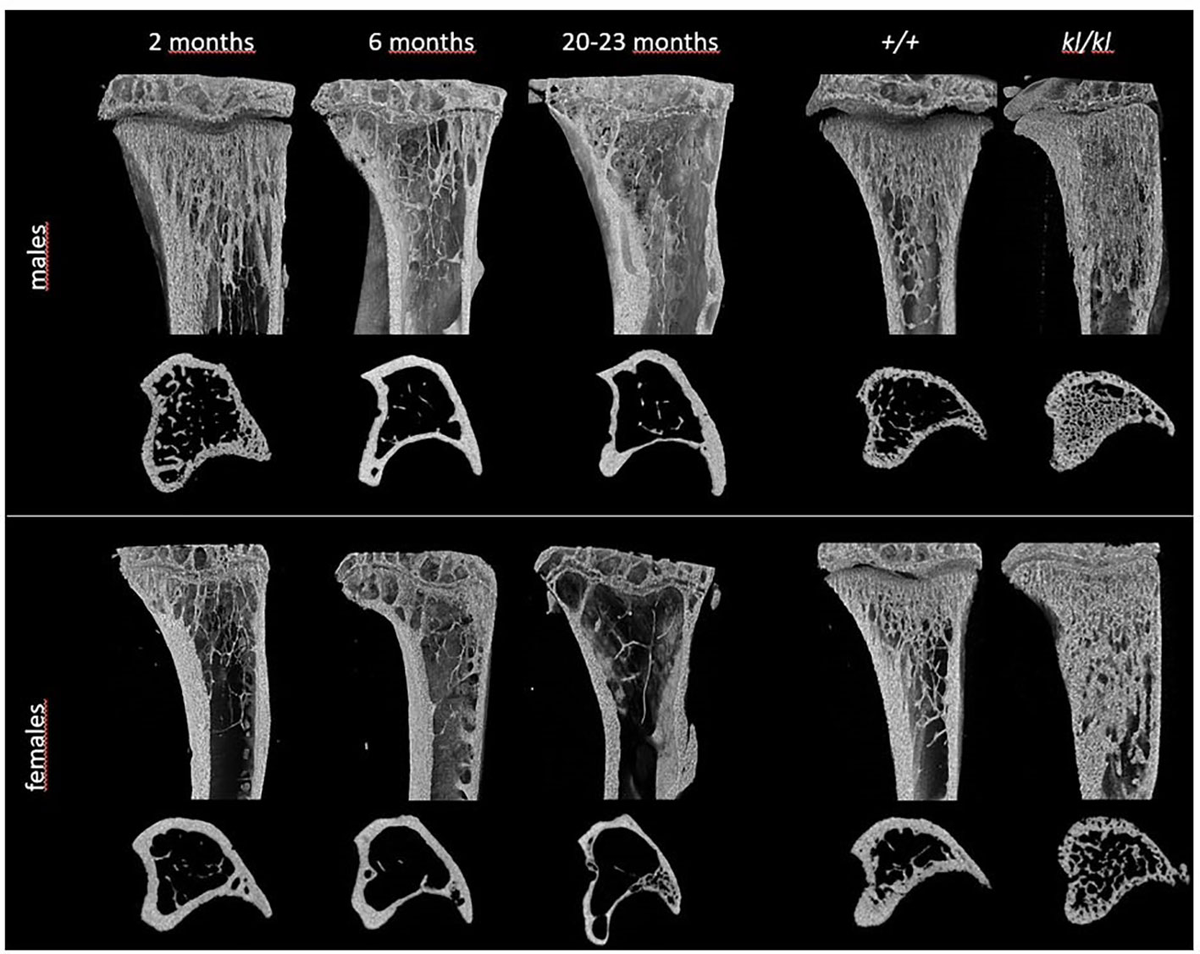 Frontiers | Relationship of the bone phenotype of the Klotho mutant ...