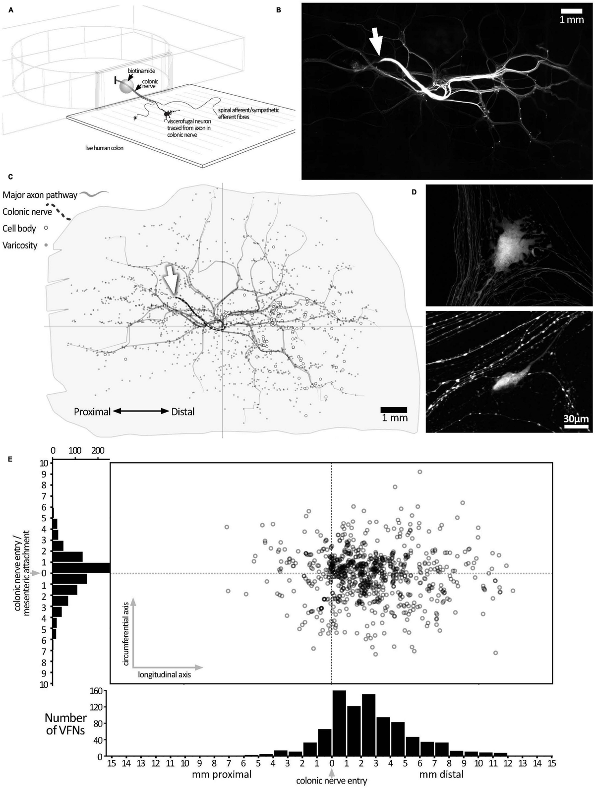 Frontiers | Characterization of viscerofugal neurons in human colon by ...