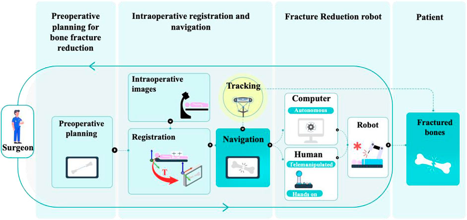 Frontiers | Technologies evolution in robot-assisted fracture reduction ...