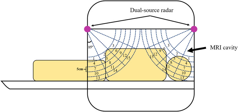 Frontiers | Feasibility of the application of frequency modulated ...