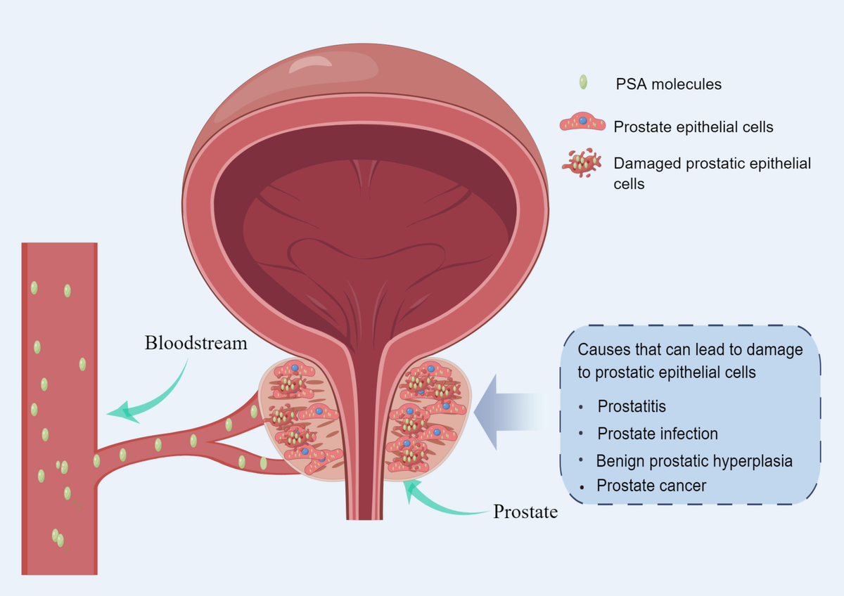 Frontiers | Application and optimization of prostate-specific antigen ...