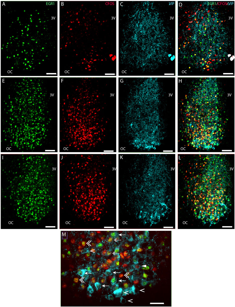 Frontiers | Phenotyping of light-activated neurons in the mouse SCN ...