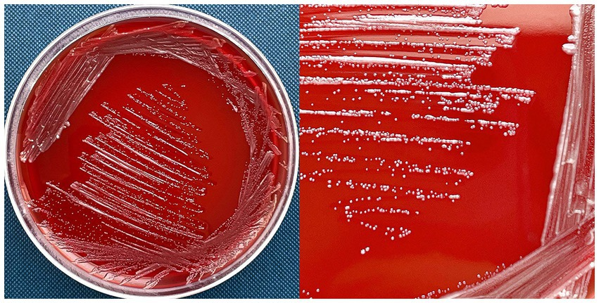 Frontiers | Genomic analysis of multidrug-resistant Delftia ...