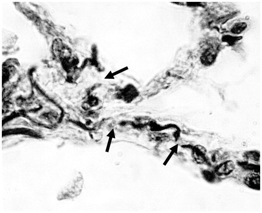 Frontiers | Desmosine as a biomarker for the emergent properties of ...