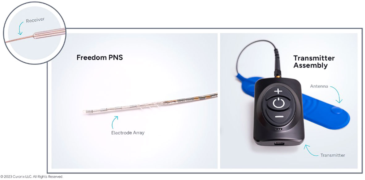 Frontiers | Peripheral nerve stimulation for pudendal neuralgia and ...