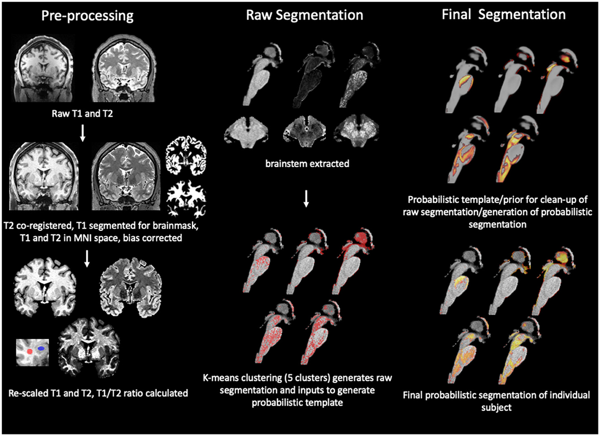 Frontiers | Mapping internal brainstem structures using T1 and T2 weighted 3T images