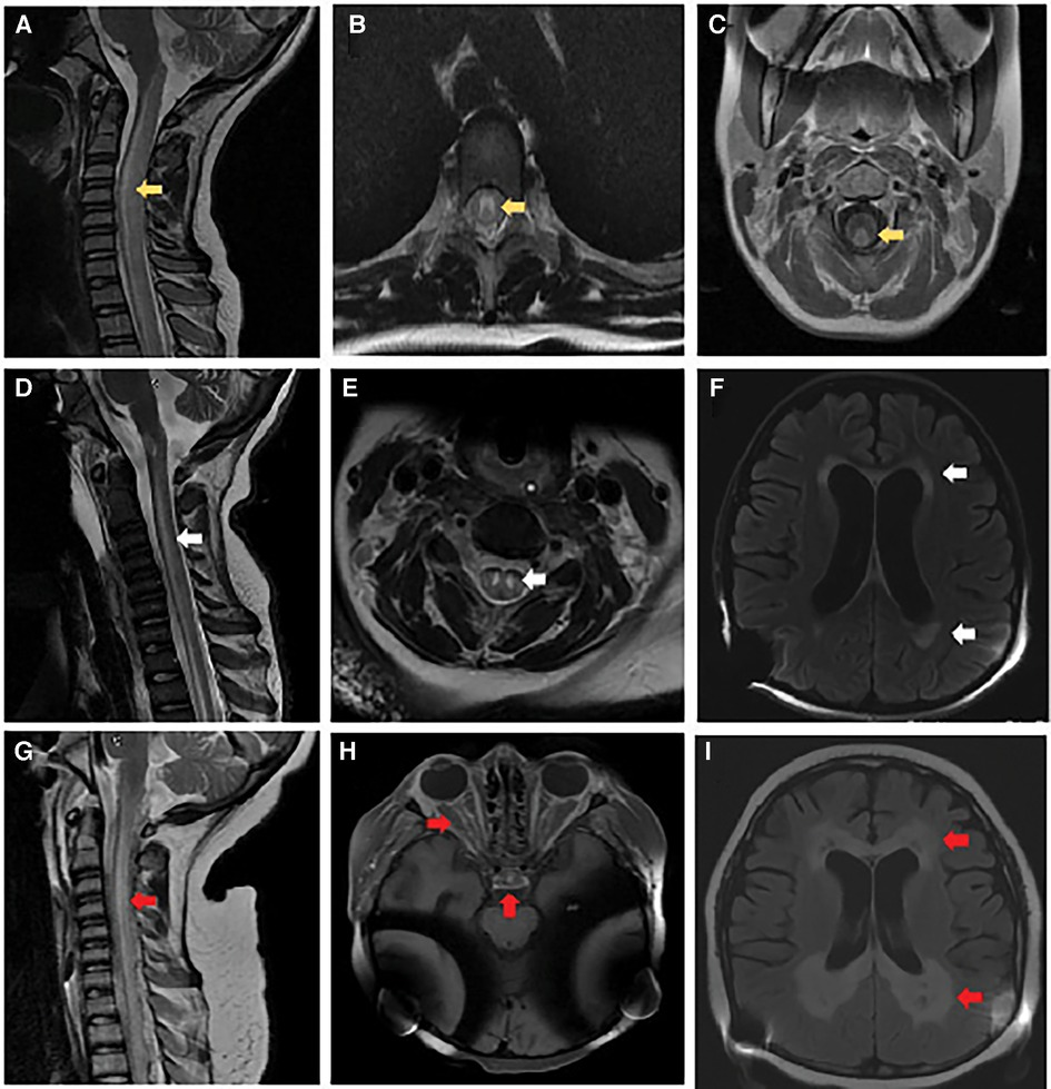 Frontiers | Generation and characterization of a zebrafish gain-of ...