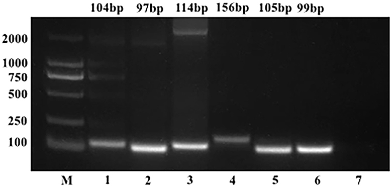 Frontiers | A multiplex real-time fluorescence-based quantitative PCR assay for calf diarrhea ...