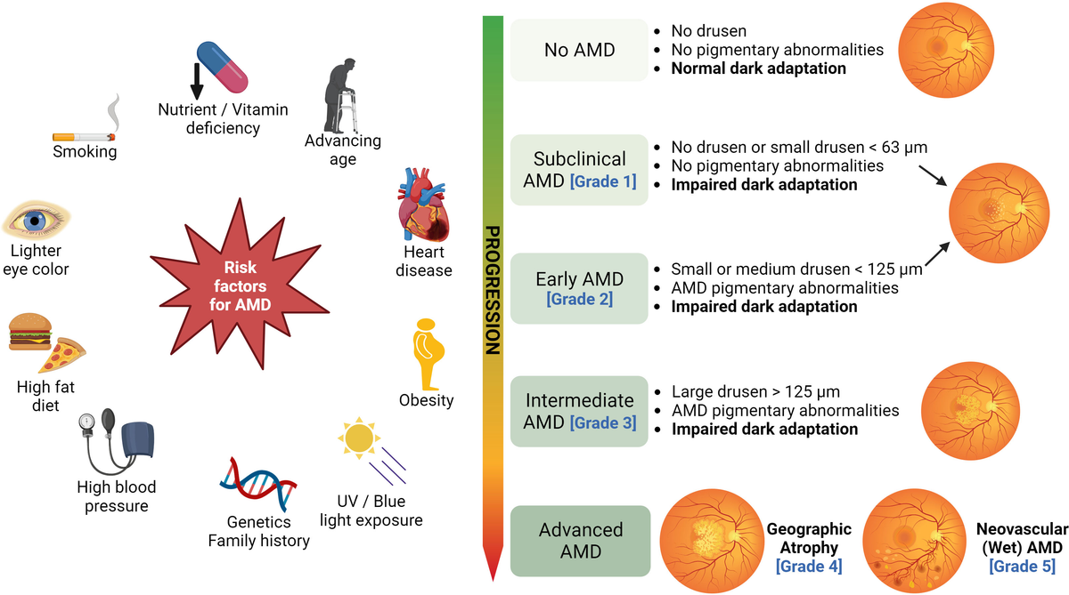 Frontiers | Geographic atrophy: pathophysiology and current therapeutic ...