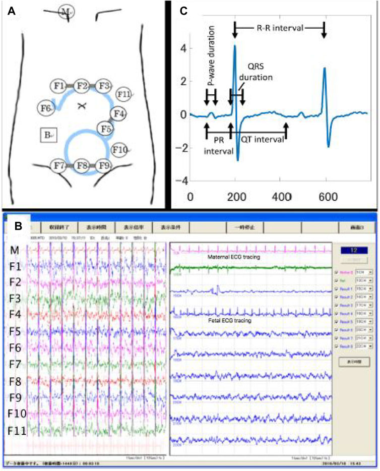 Frontiers | A deep learning framework for noninvasive fetal ECG signal ...