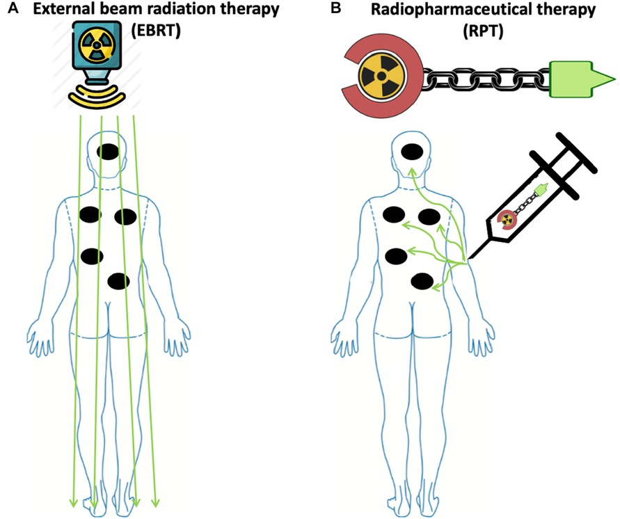 Frontiers | Immunological effects of radiopharmaceutical therapy