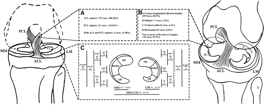 Frontiers | Epidemiology and distribution of cruciate ligament injuries ...