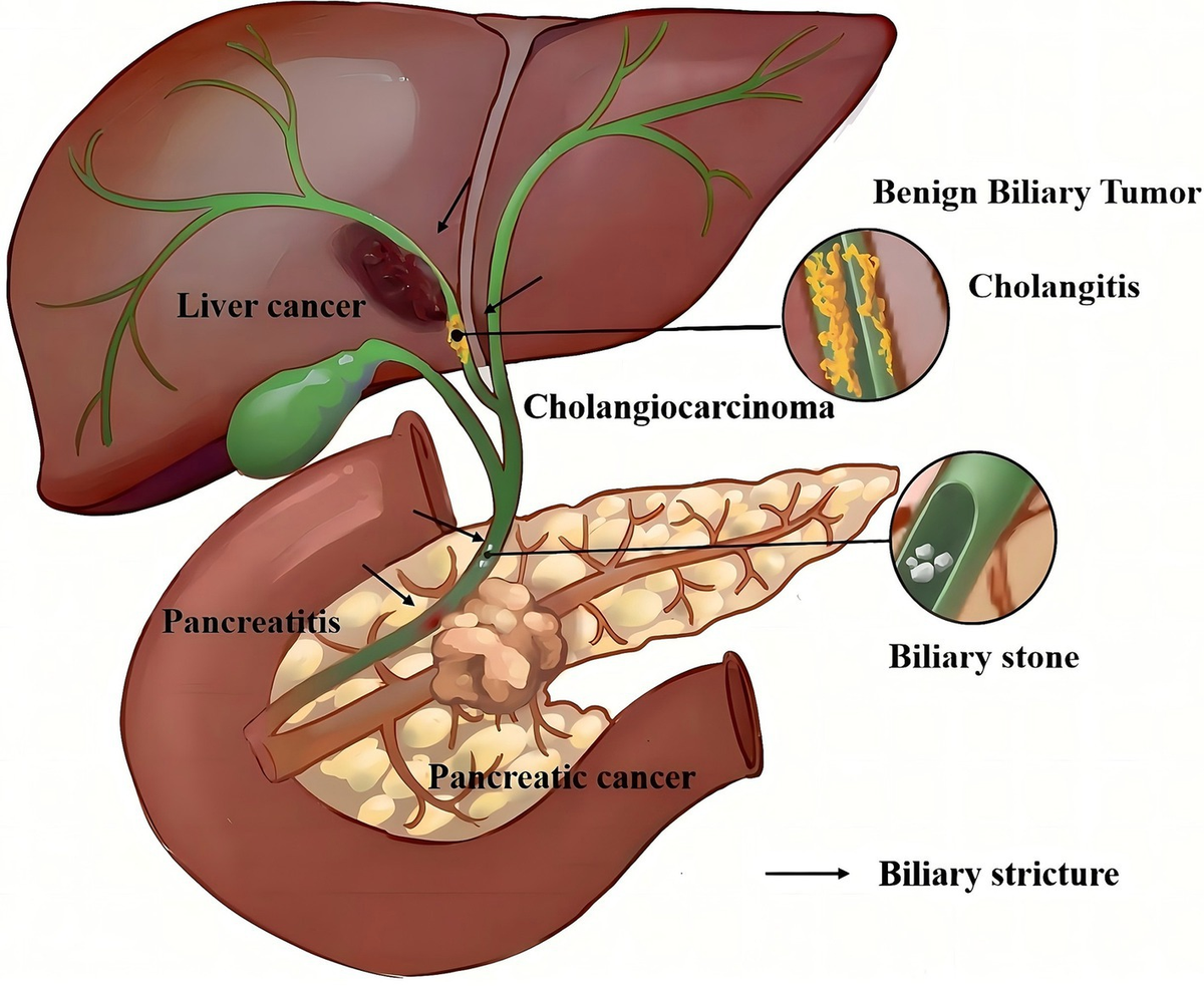 Frontiers | The past, present, and future of endoscopic management for ...