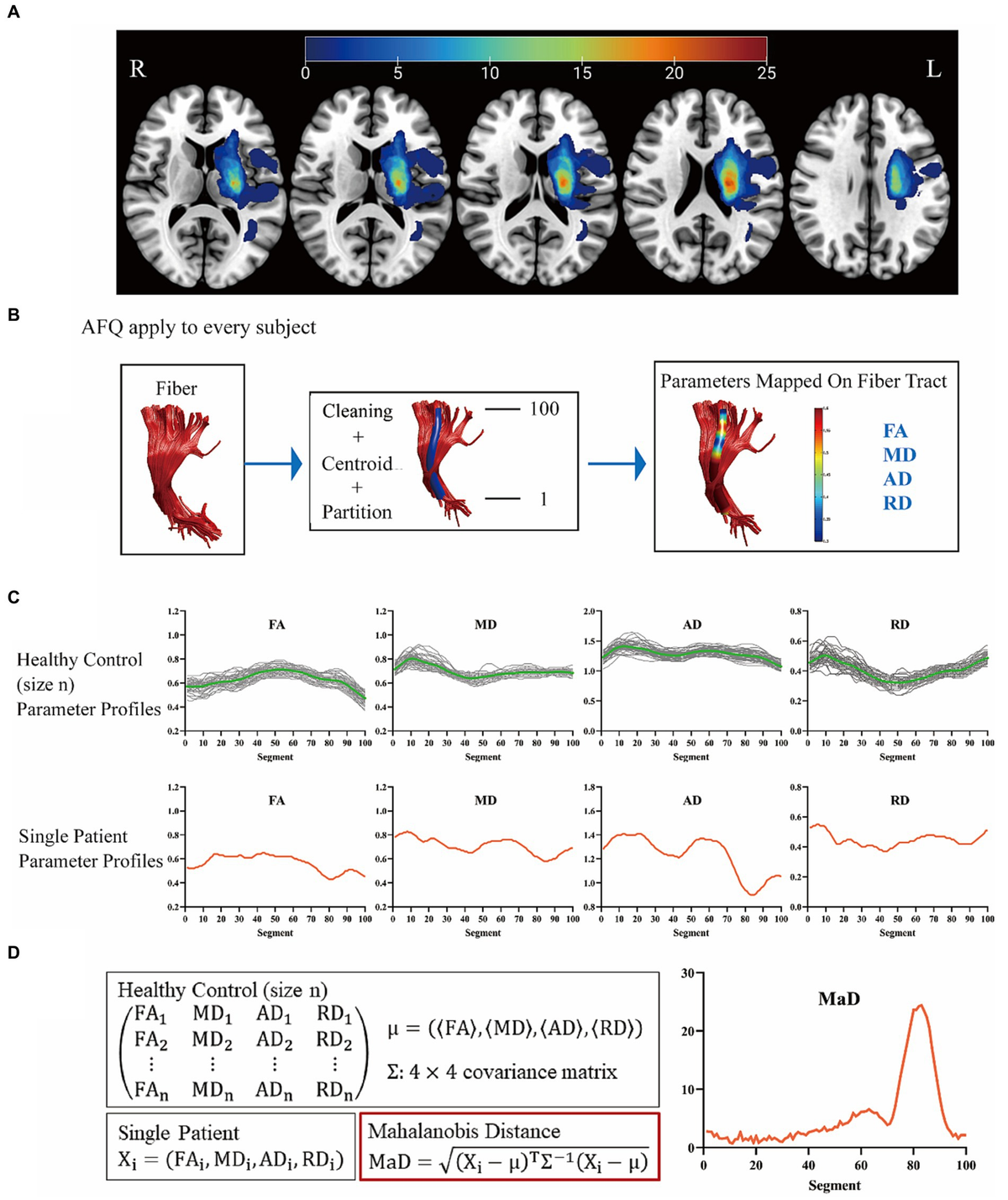Frontiers | A normative modeling approach to quantify white matter ...