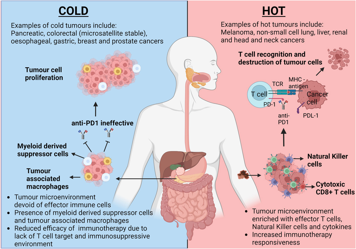 Frontiers | Exercise to transform tumours from cold to hot and improve ...