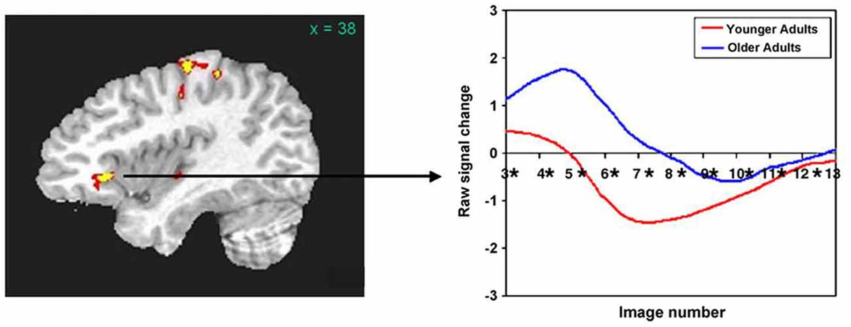 Frontiers | The relevance of aging-related changes in brain function to ...