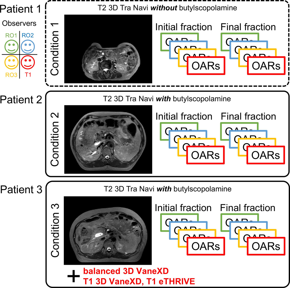 Frontiers | A pilot study on interobserver variability in organ-at-risk ...