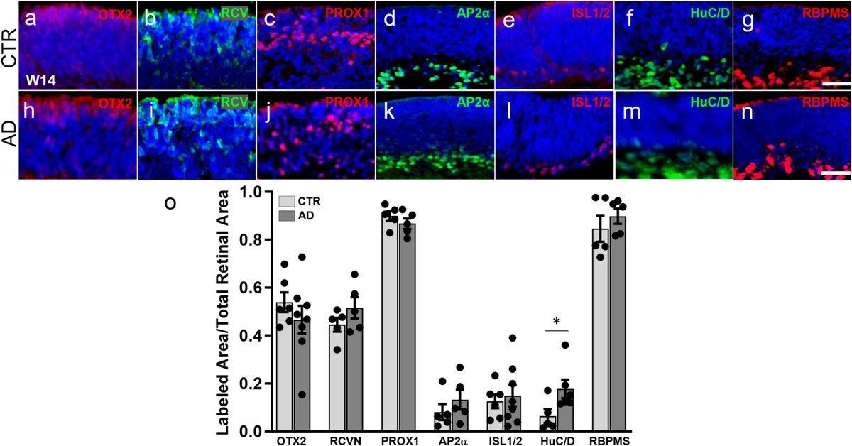 Frontiers | Human iPSC-derived retinal organoids develop robust ...