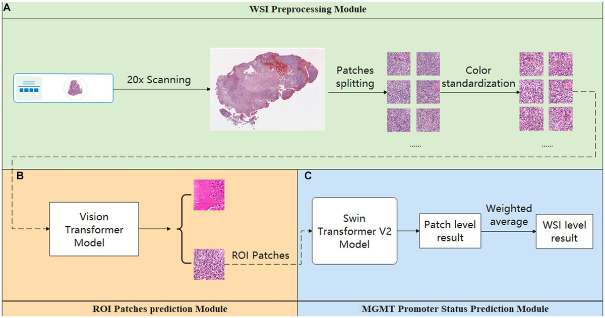 Frontiers | Computational pathology-based weakly supervised prediction model for MGMT promoter ...