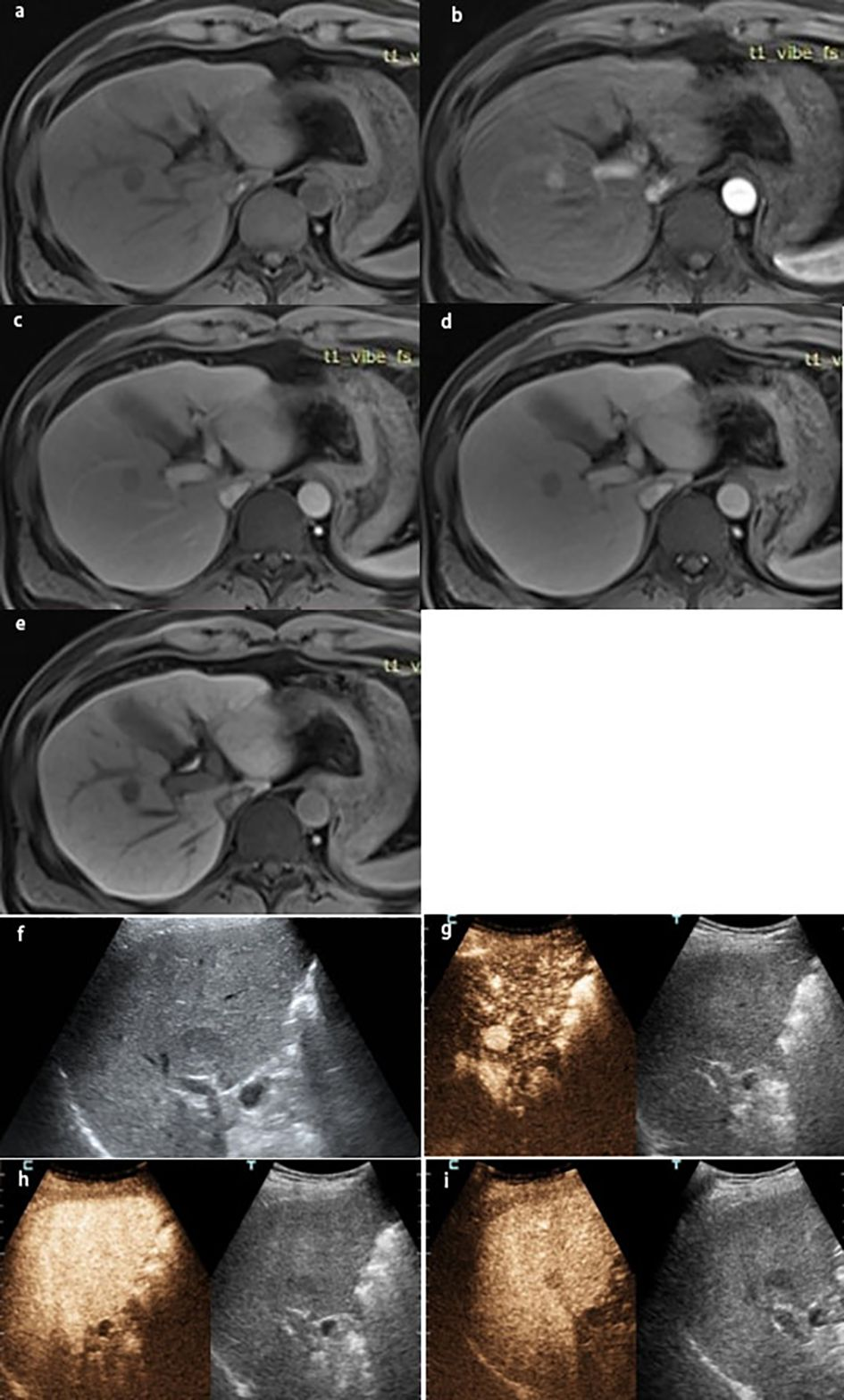 Frontiers | The comparison of contrast-enhanced ultrasound and ...