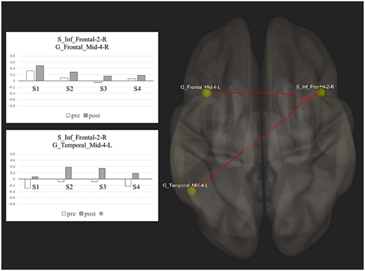 Frontiers | Increased interhemispheric functional connectivity after ...
