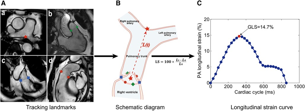 Frontiers | Characteristics of pulmonary artery strain assessed by ...