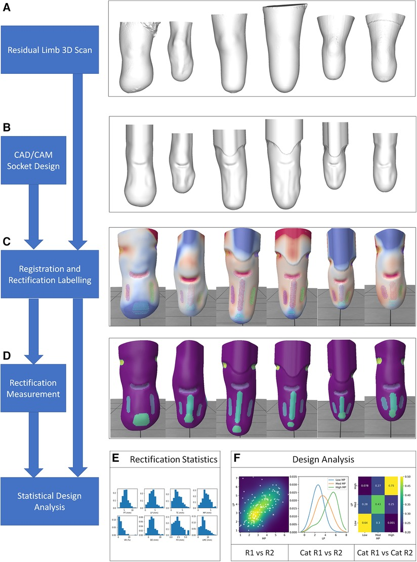 Frontiers | Insights into the spectrum of transtibial prosthetic socket ...