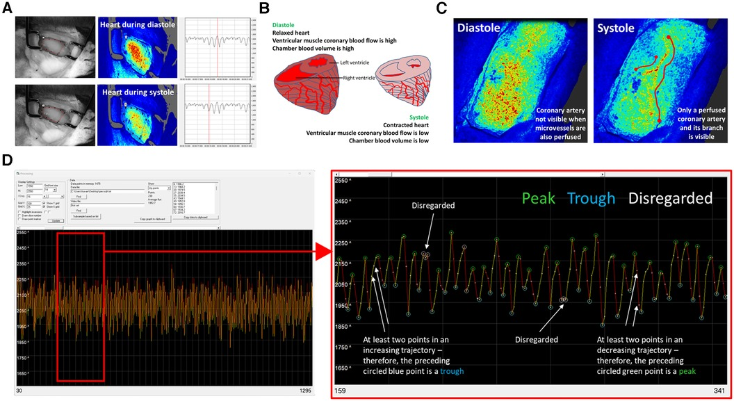 Frontiers | Monitoring coronary blood flow by laser speckle contrast ...