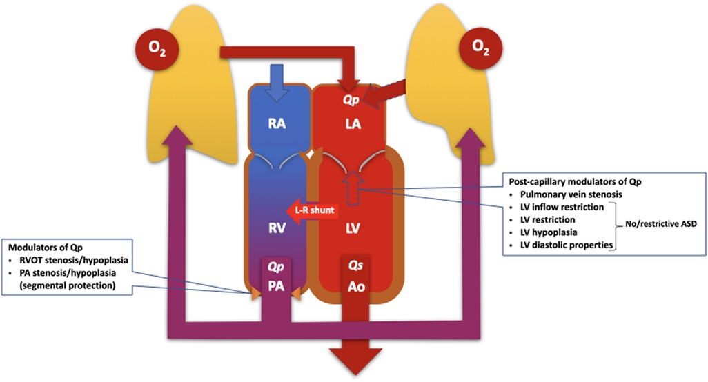 Frontiers | Pulmonary arterial hypertension related to congenital heart ...