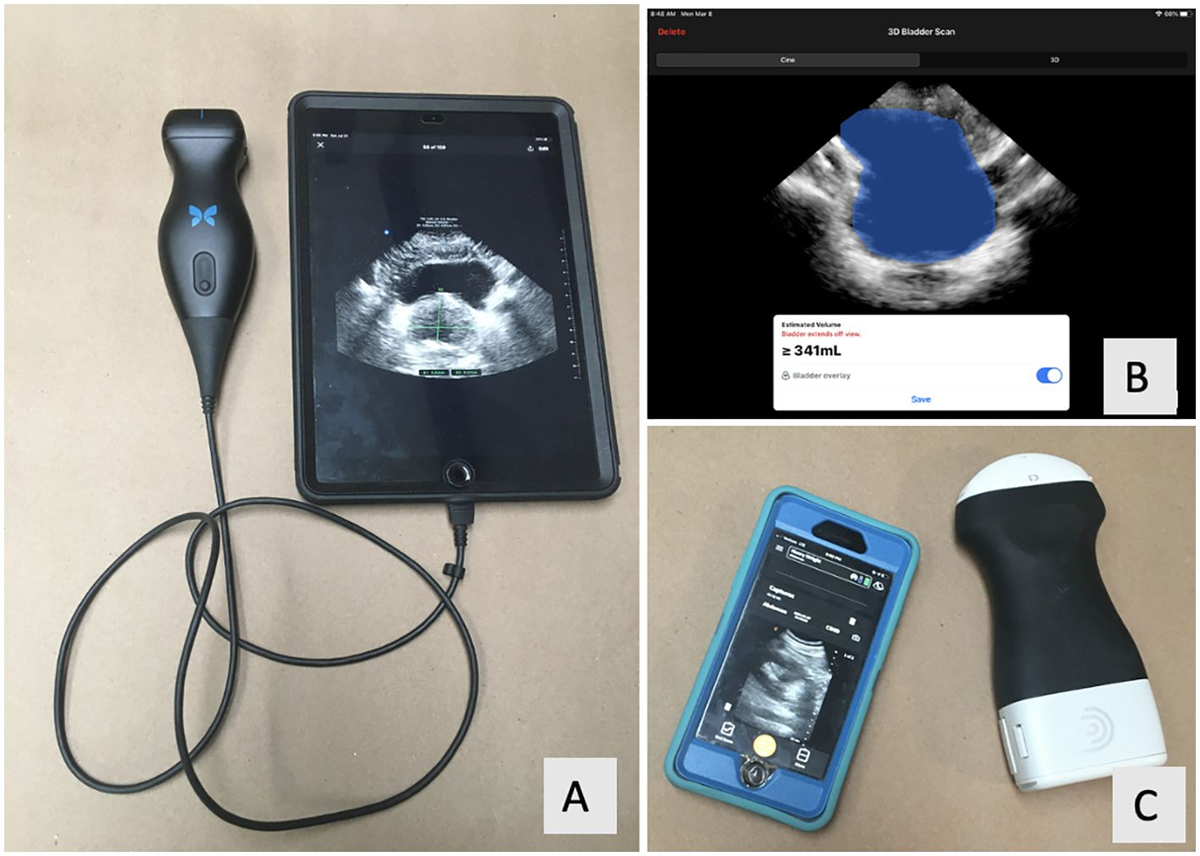 Frontiers | Can handheld ultrasound probes reliably measure ...