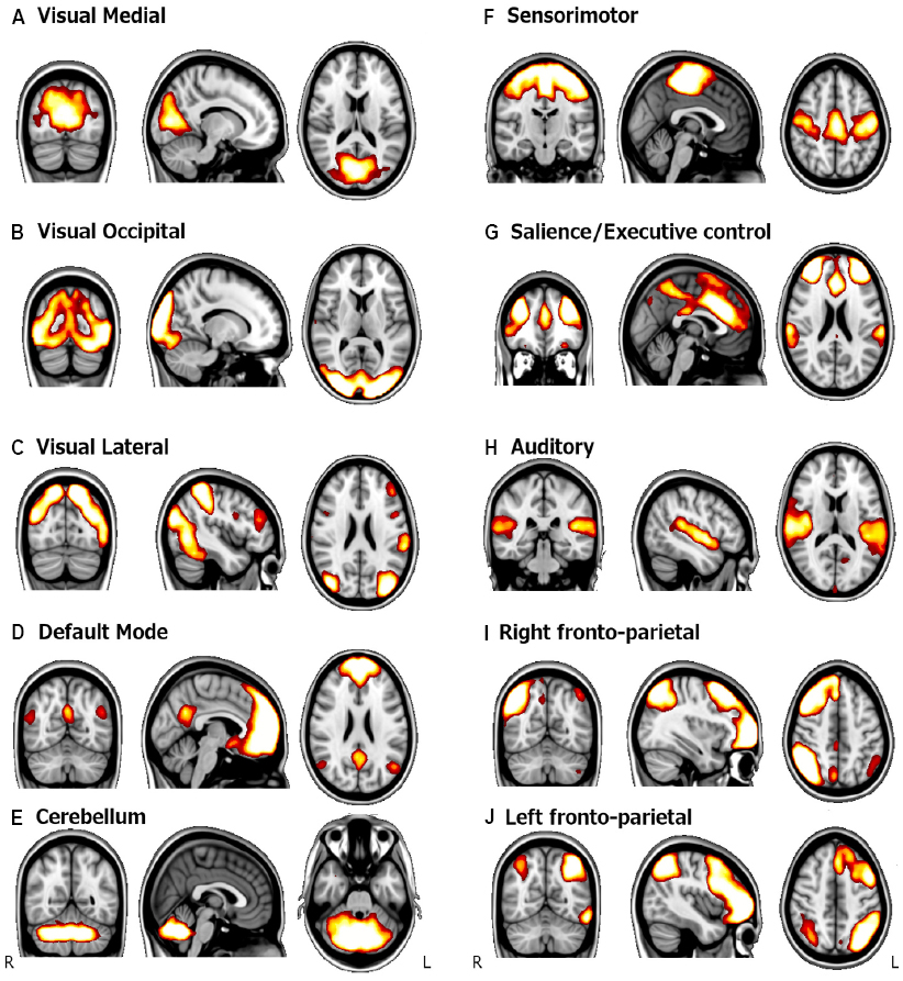 Frontiers | Reorganization of brain networks in aging: a review of ...