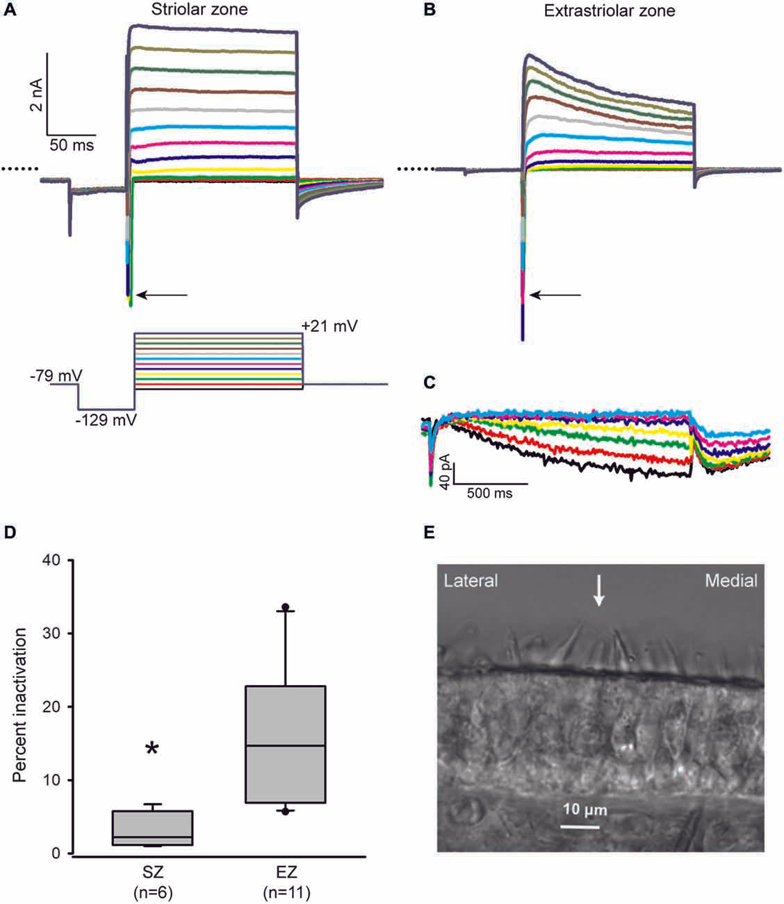 Frontiers | Kv1 channels and neural processing in vestibular calyx ...
