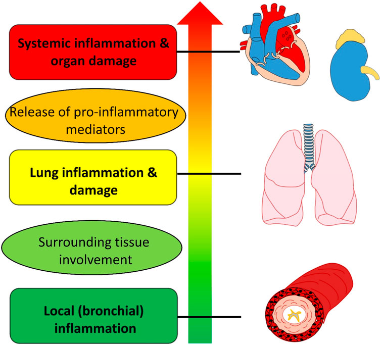 Frontiers | Editorial: Treatment of comorbidities of asthma and its safety