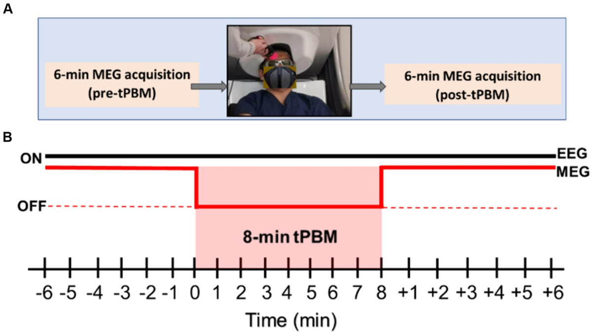 Frontiers | Simultaneous MEG and EEG source imaging of ...