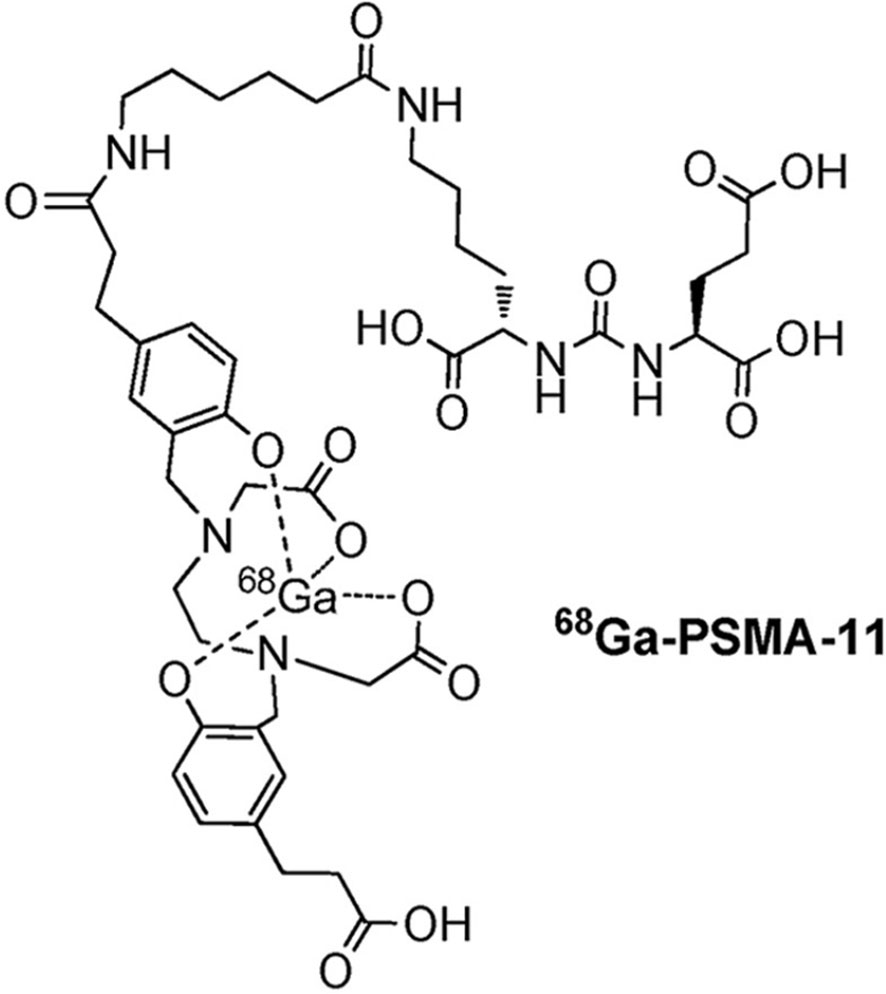Frontiers | Advancements in PSMA ligand radiolabeling for diagnosis and ...
