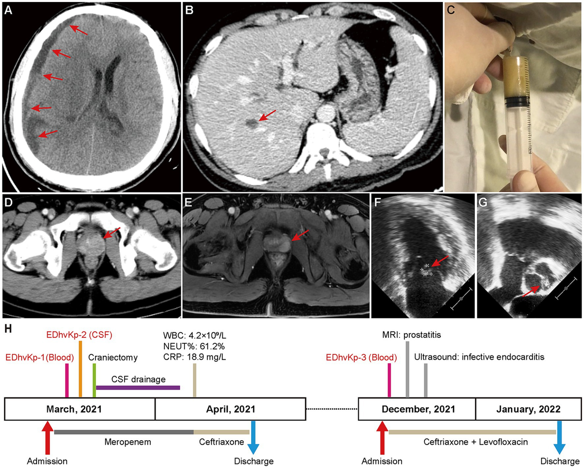 Frontiers | Genomic surveillance indicates clonal replacement of ...