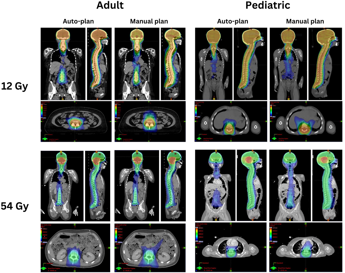 Frontiers | Automated contouring, treatment planning, and quality ...