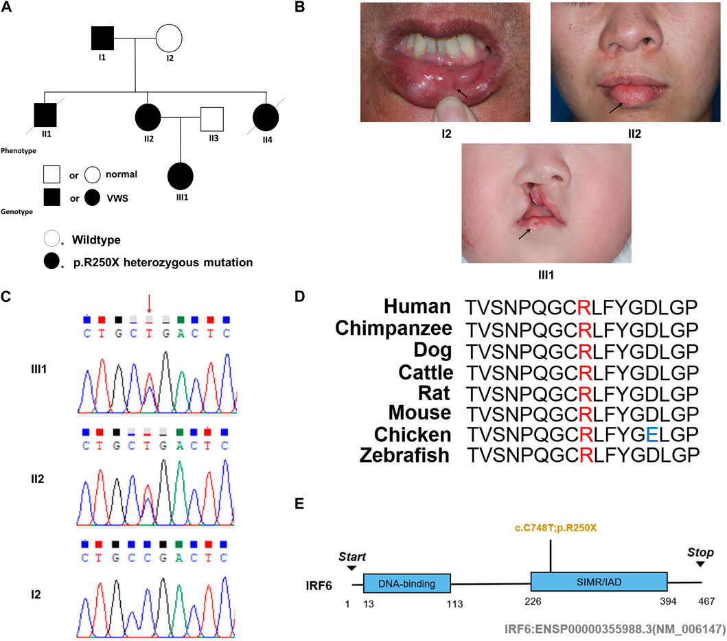 Frontiers | A novel IRF6 gene mutation impacting the regulation of ...