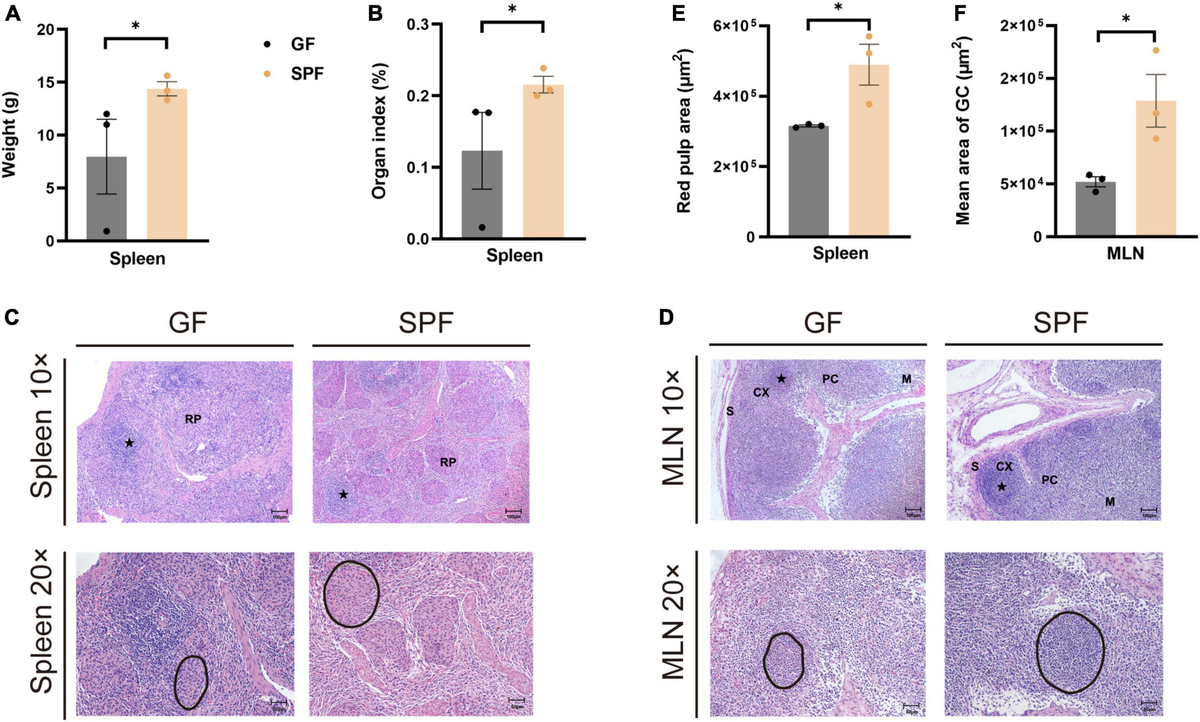 Frontiers | Effects of the commensal microbiota on spleen and ...