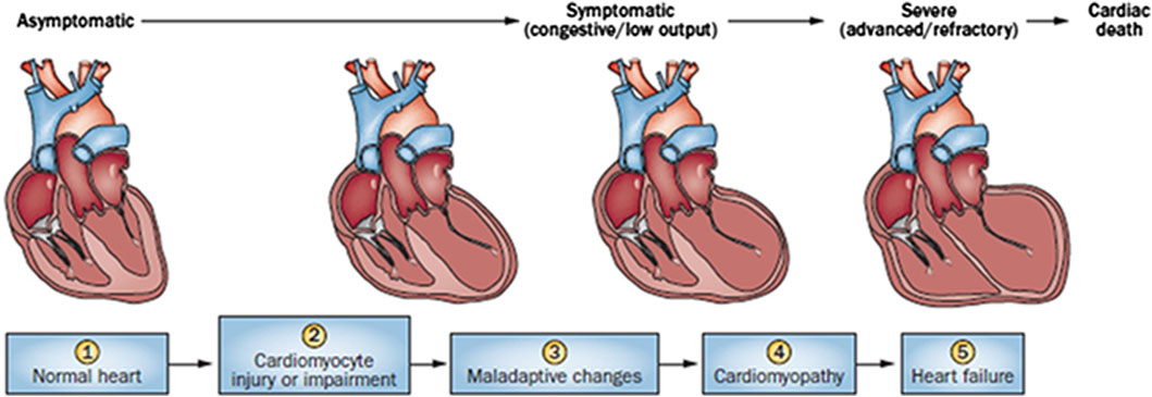 Frontiers | An update of the molecular mechanisms underlying ...