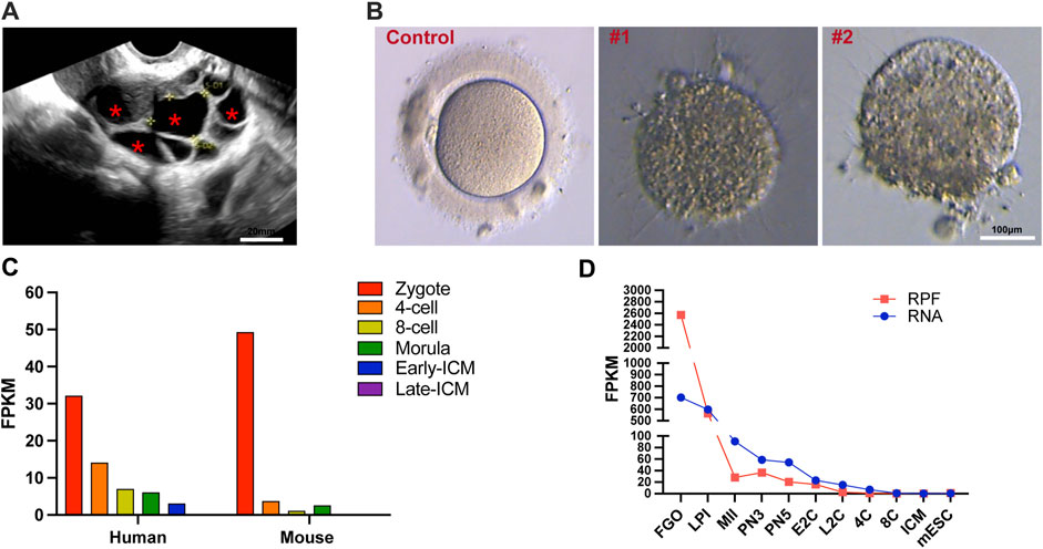 Frontiers | ZP1-Y262C mutation causes abnormal zona pellucida formation ...