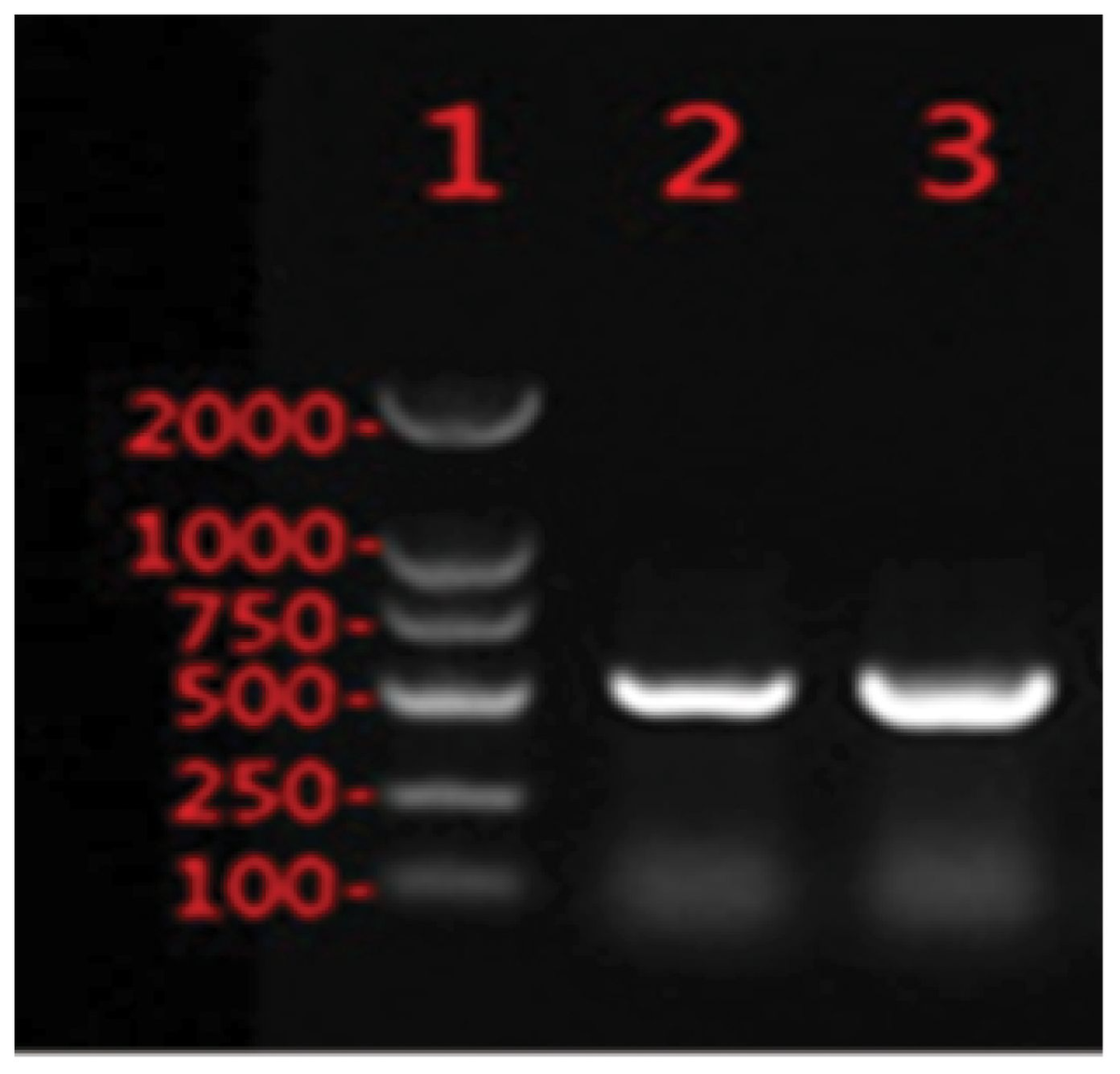 Frontiers | Molecular characteristics and pathogenic mechanisms of KPC ...
