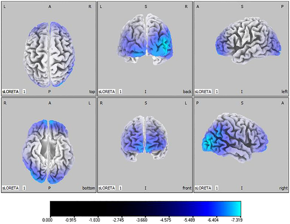 Frontiers | Effects of transcranial direct current stimulation on brain ...