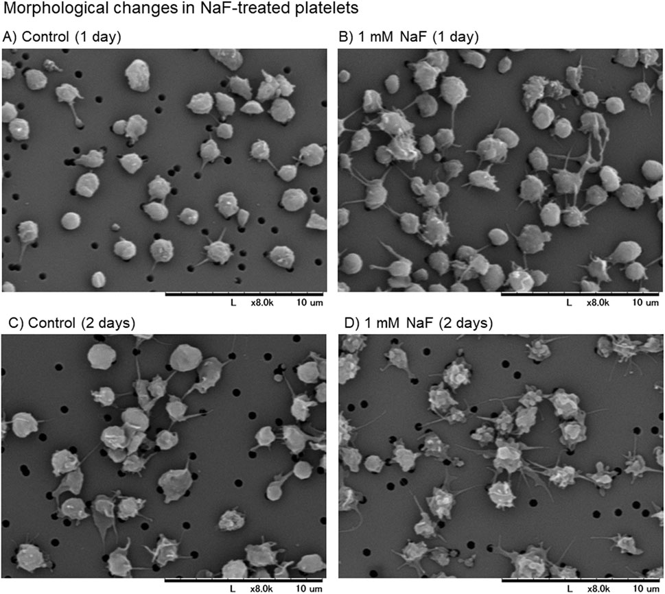 Frontiers | Inhibitory effects of NaF on mitochondrial energy ...