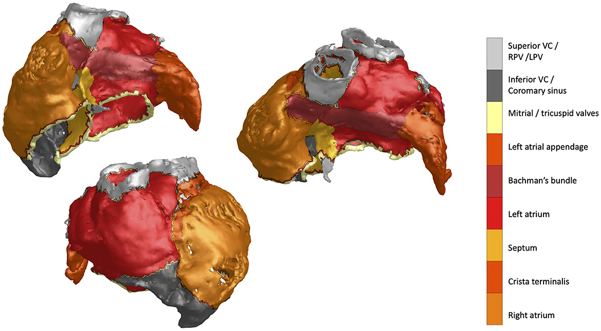 Frontiers | Interactive teaching of medical 3D cardiac anatomy: atrial ...